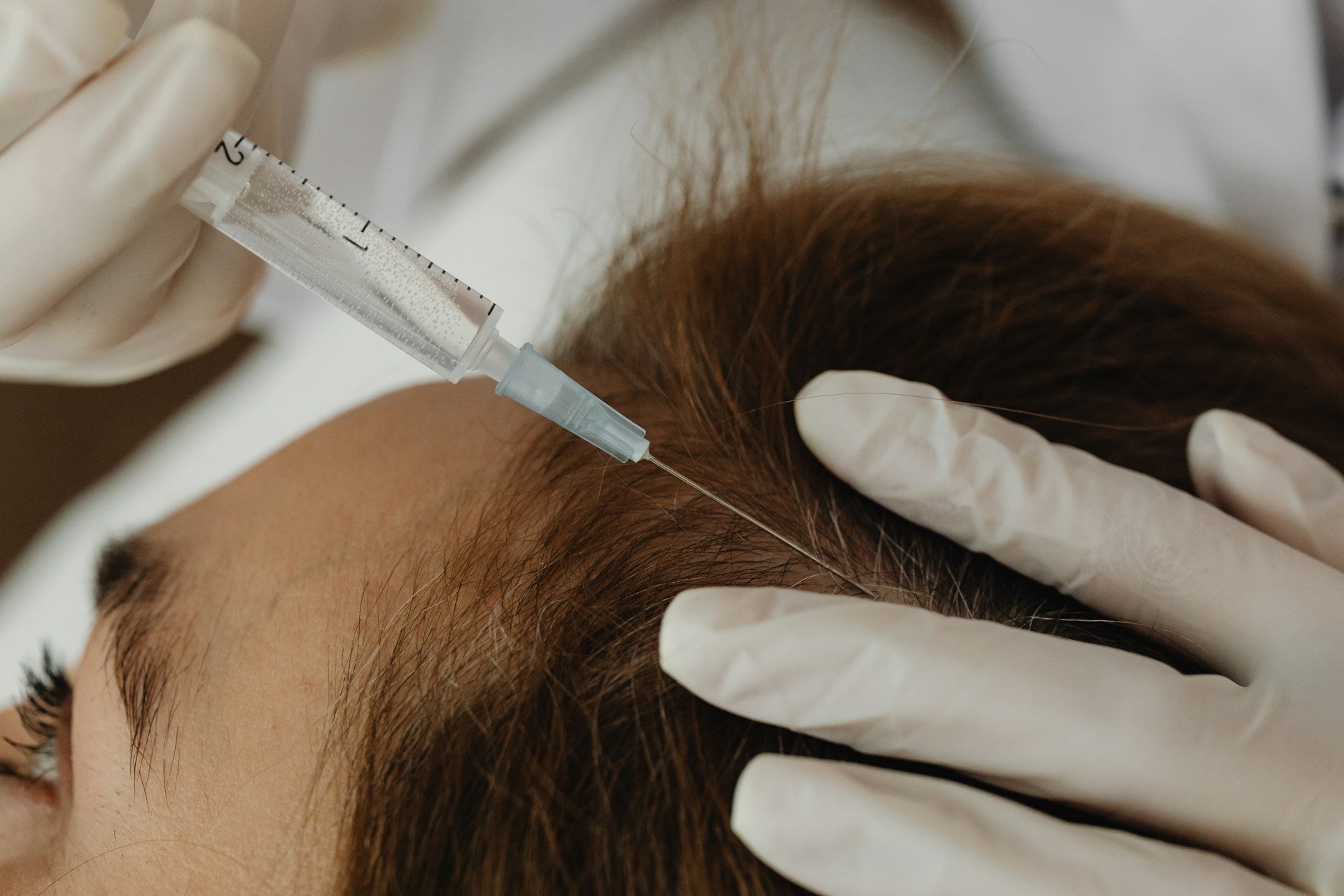 Why Does Hair Restoration in Las Vegas Work Better in Winter? – Abrams ...